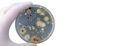 What Is Bioburden and How to Control It | Meridian Medical